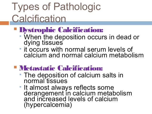 Calcification Vs. Ossification: What’S The Difference? – EOYS