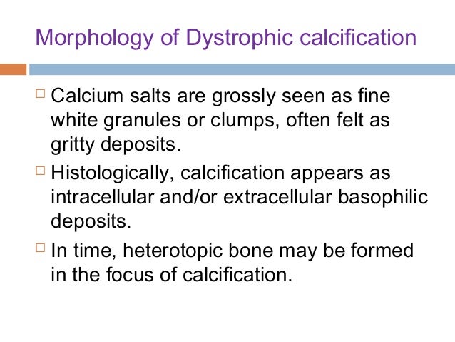 Pathologic calcification