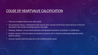 Pathological calcification of implants | PPTX