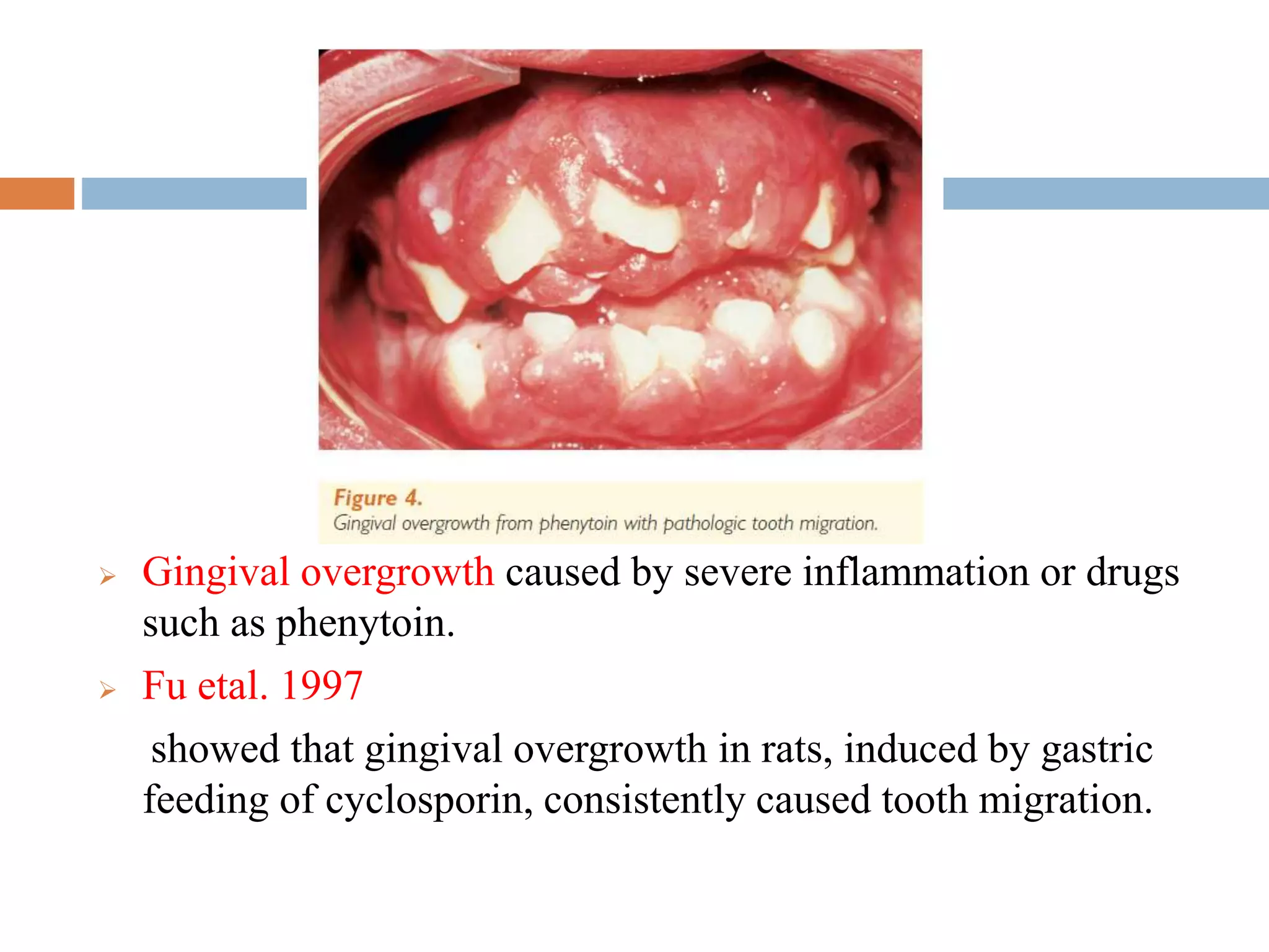 Pathologic migration | PPTX