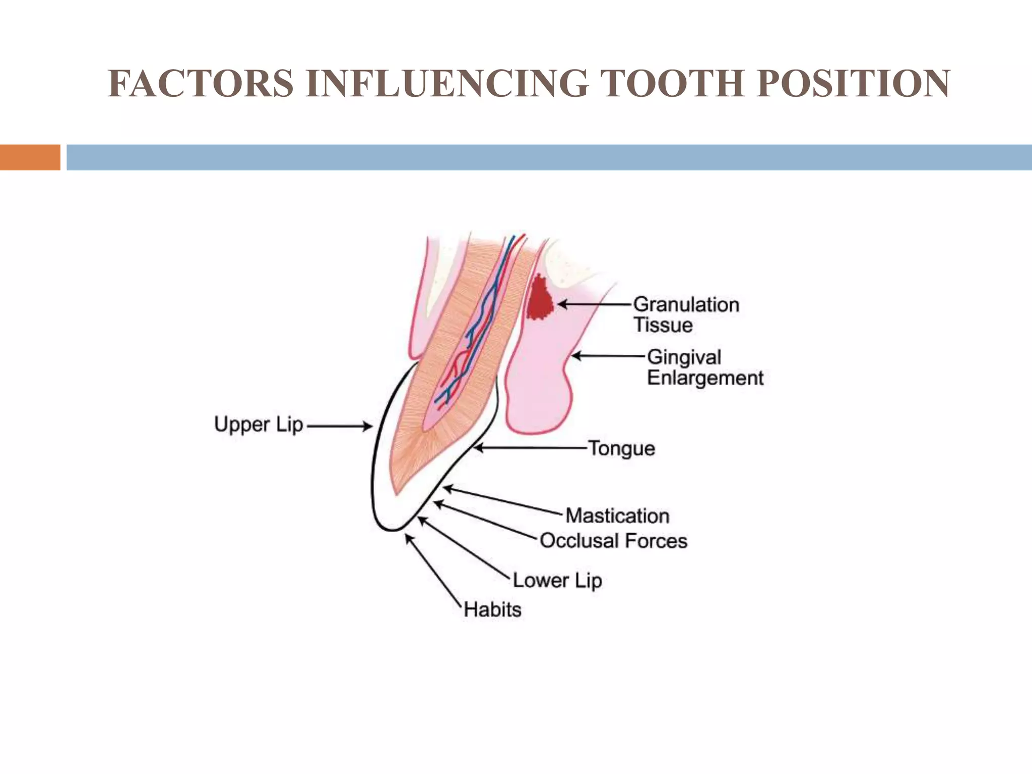 Pathologic migration | PPTX