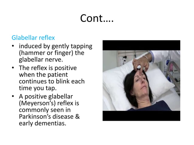 Pathologic Reflexes, Monofilament Tests & Meningeal Signs.pptx | Death ...