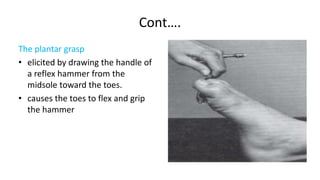 Pathologic Reflexes, Monofilament Tests & Meningeal Signs.pptx