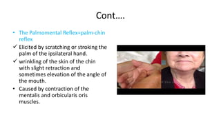 Pathologic Reflexes, Monofilament Tests & Meningeal Signs.pptx