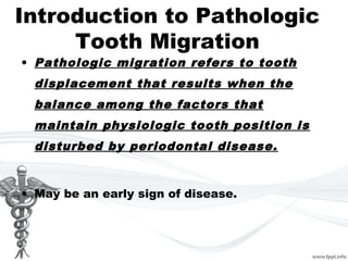Traumatic Occlusion and Pathologic tooth migration | PPT
