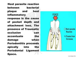 Traumatic Occlusion and Pathologic tooth migration | PPT