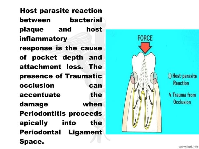 Traumatic Occlusion and Pathologic tooth migration | PPT | Dental ...