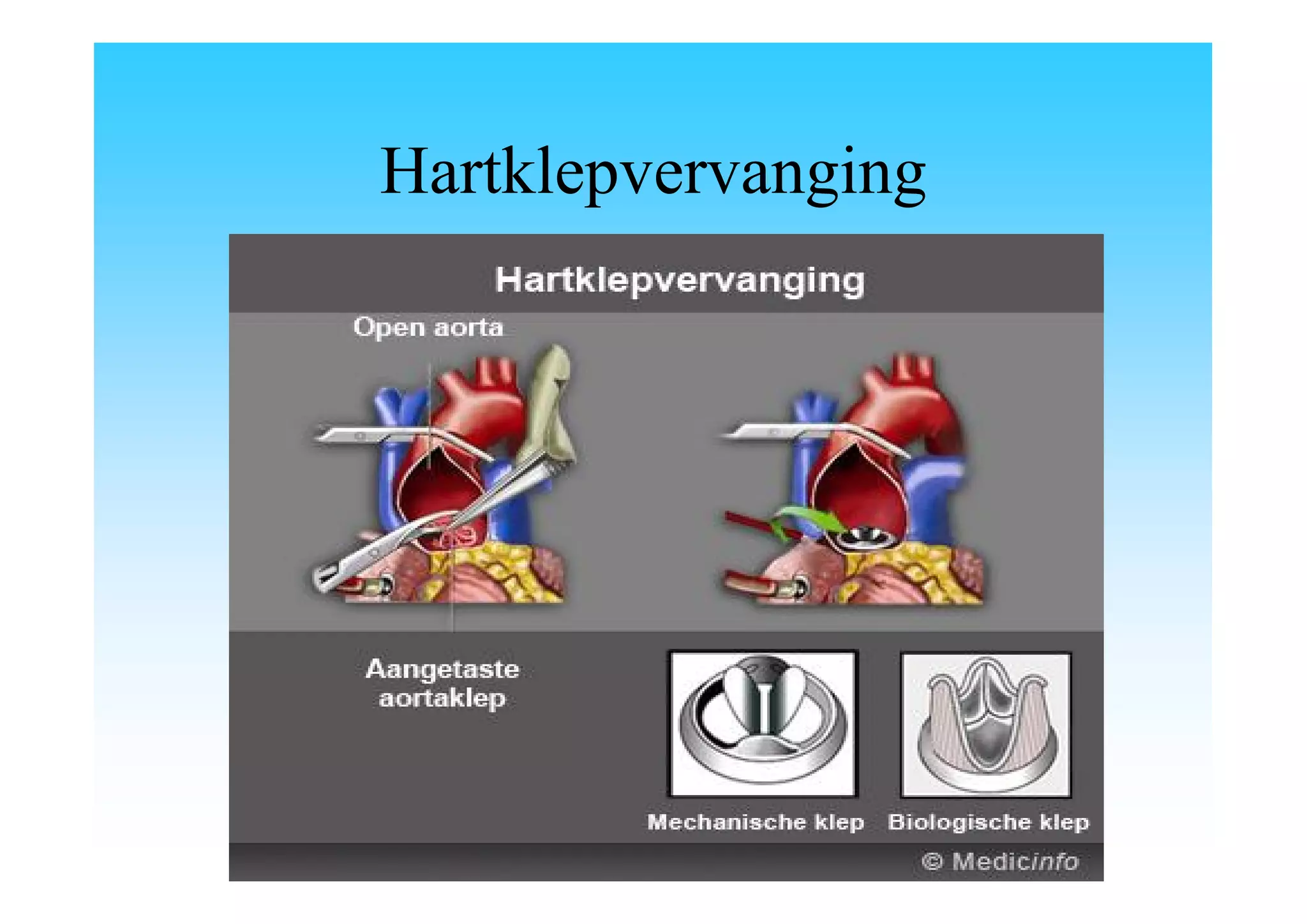 Pathologie hart bloedvaten | PDF | Lung and Respiratory Health ...