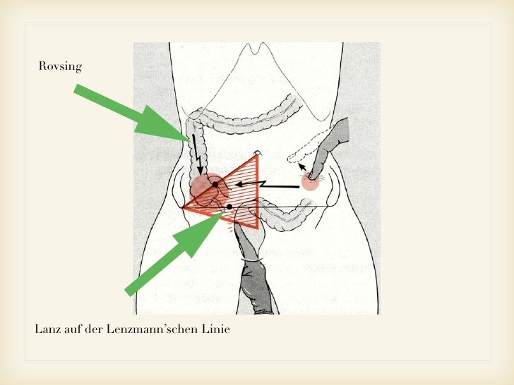 Pathologien Der Appendix.Key