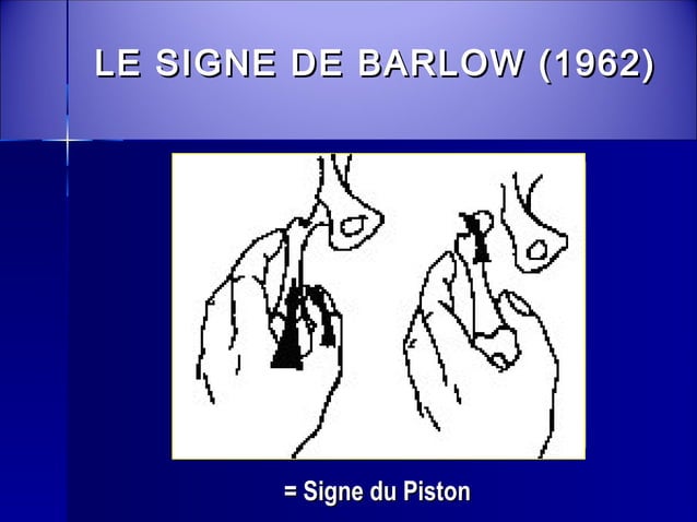 Pathologie ortho de l'enfant module 1 | PPT