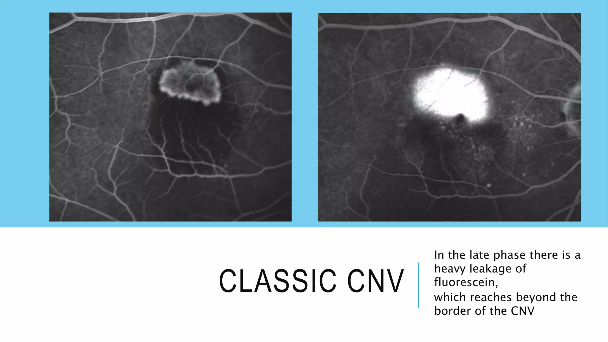 Pathologies in ffa | PPTX