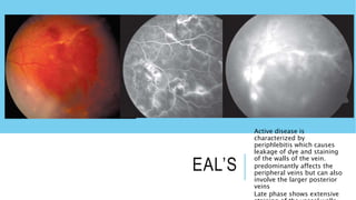 Pathologies in ffa | PPTX