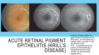 Pathologies in ffa | PPTX
