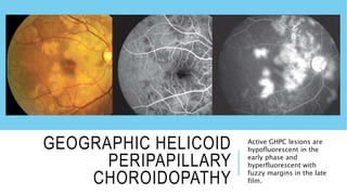 Pathologies in ffa | PPTX