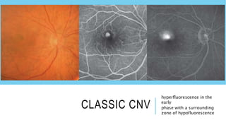 Pathologies in ffa | PPTX