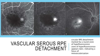 Pathologies in ffa | PPTX