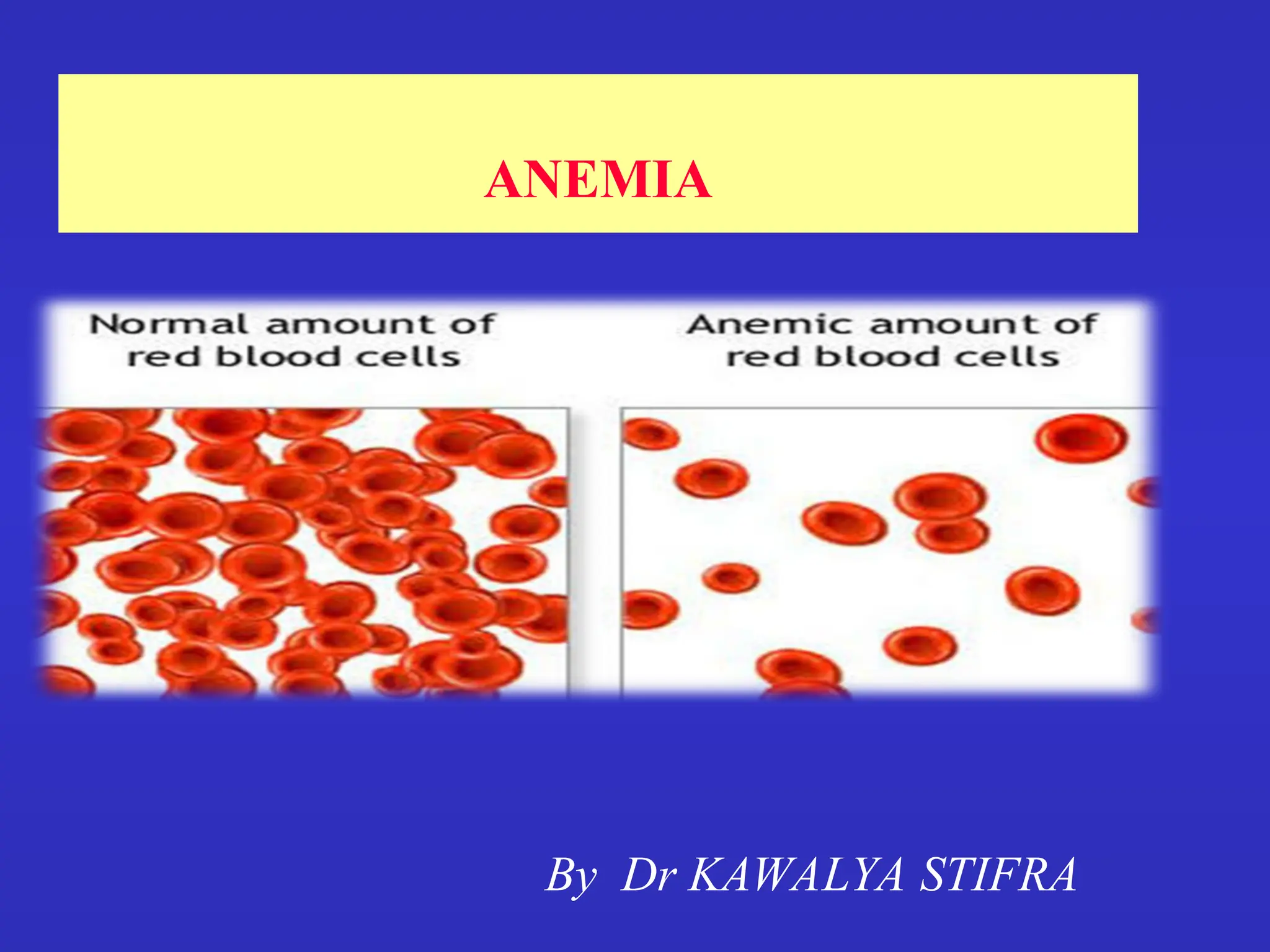 PATHOLOGIES OF ANAEMIA AND CLASSIFICATION.ppt | Blood Disorders ...