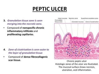 pathologiesofthegastrointestinaltract-180901164714.pptx