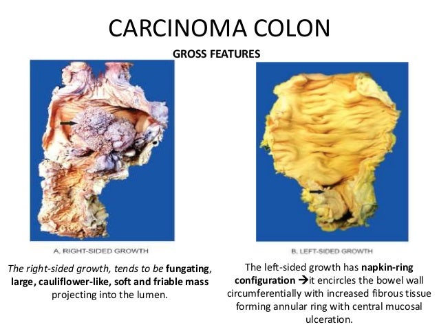 Pathologies of the gastrointestinal tract
