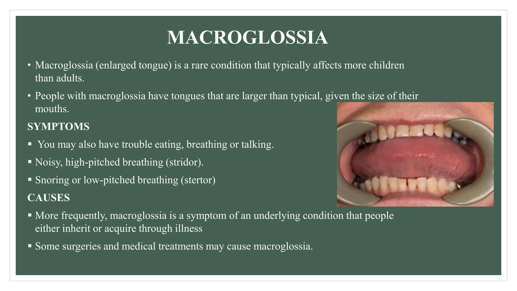 Pathologies of tongue detail presentation | PPTX