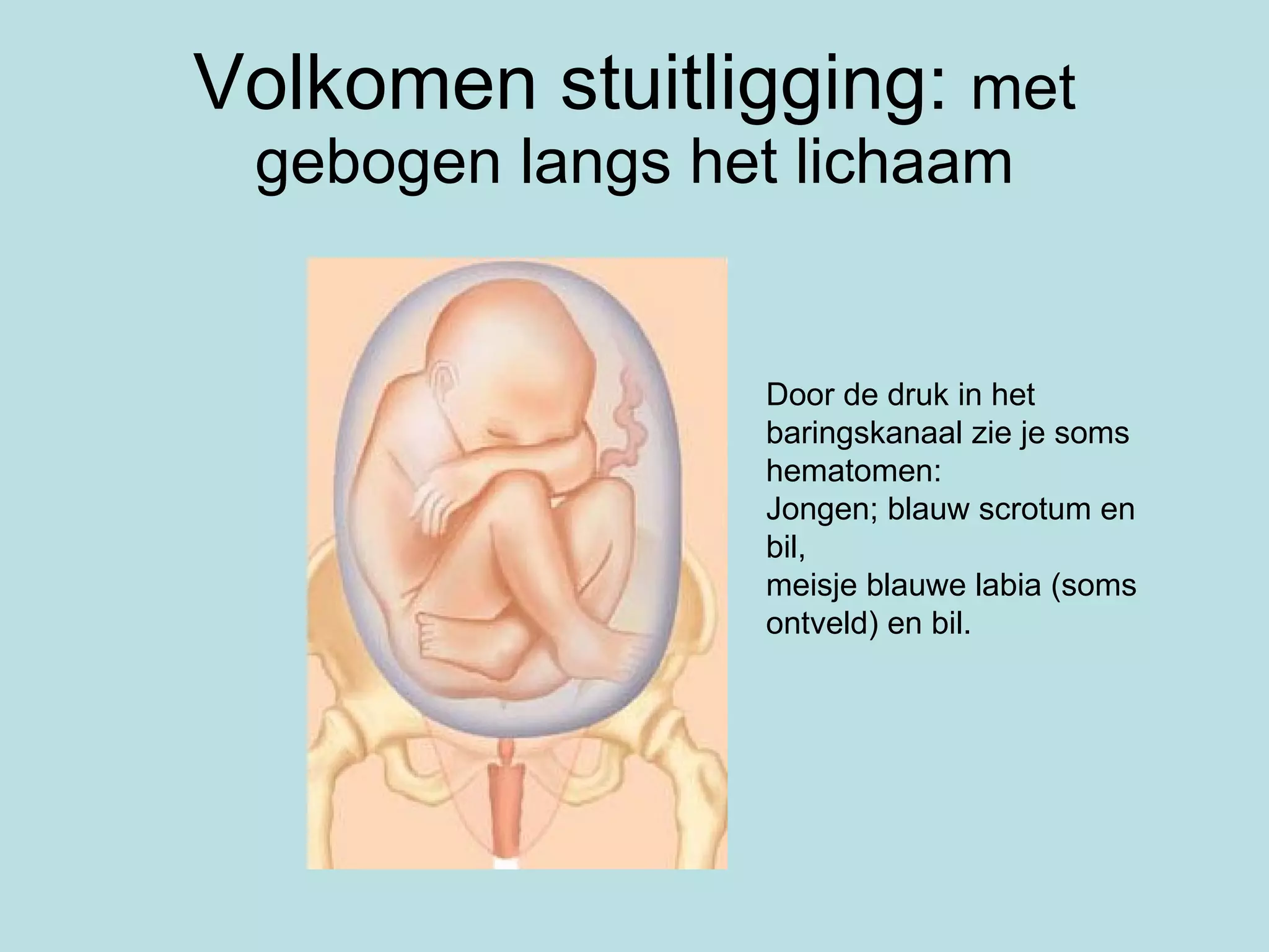 Pathologische Baring Hpk8sb | PPT