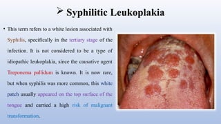 Oral Leukoplakia/ Pathology of Gastrointestinal tract.pptx