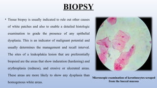 Oral Leukoplakia/ Pathology of Gastrointestinal tract.pptx