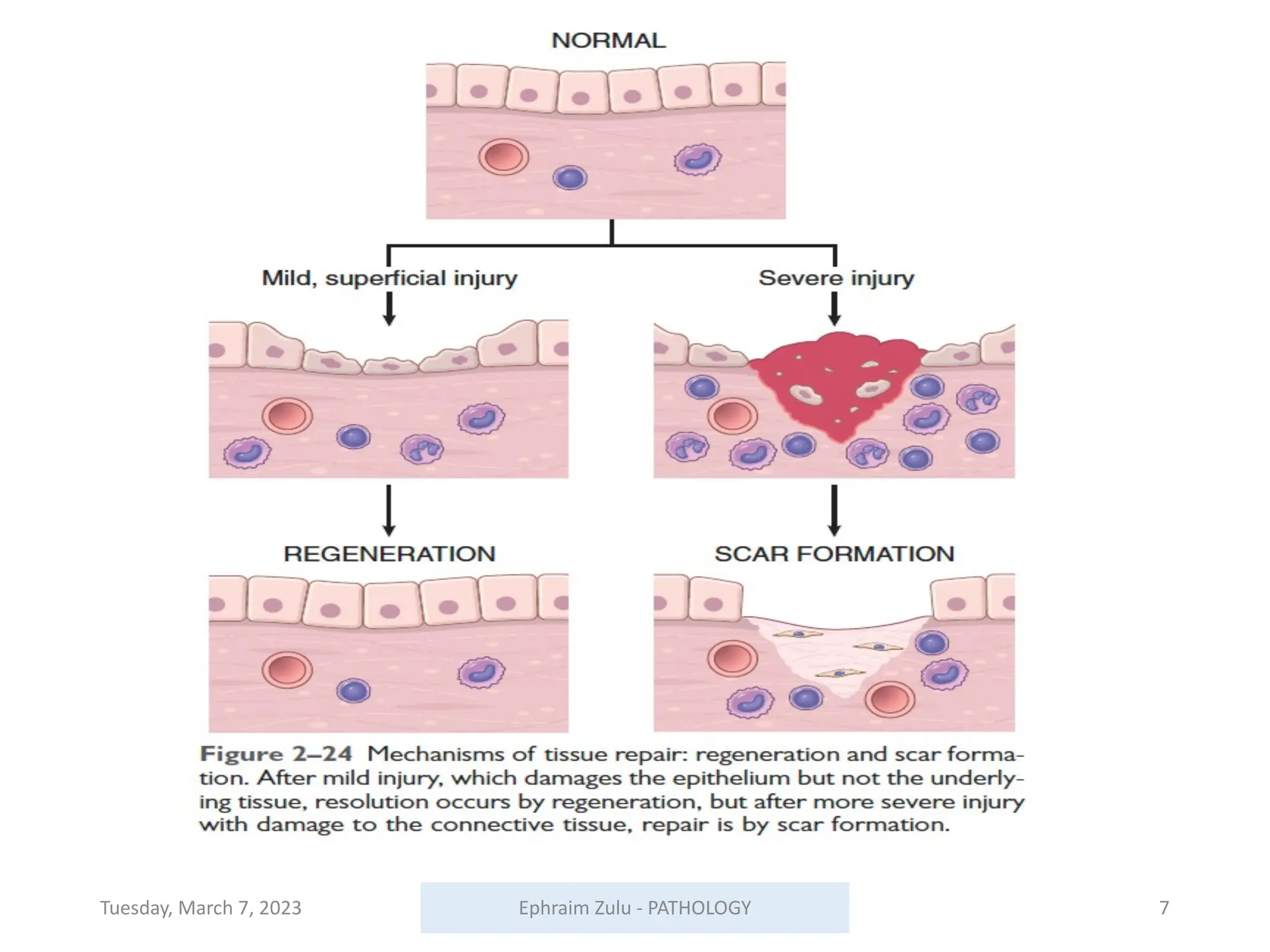 PATHOLOGY - lecture - Healing & Repair.pdf
