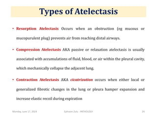 PATHOLOGY - 12 - Pulmonary Diseases 2.pdf