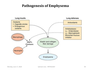 PATHOLOGY - 12 - Pulmonary Diseases 2.pdf