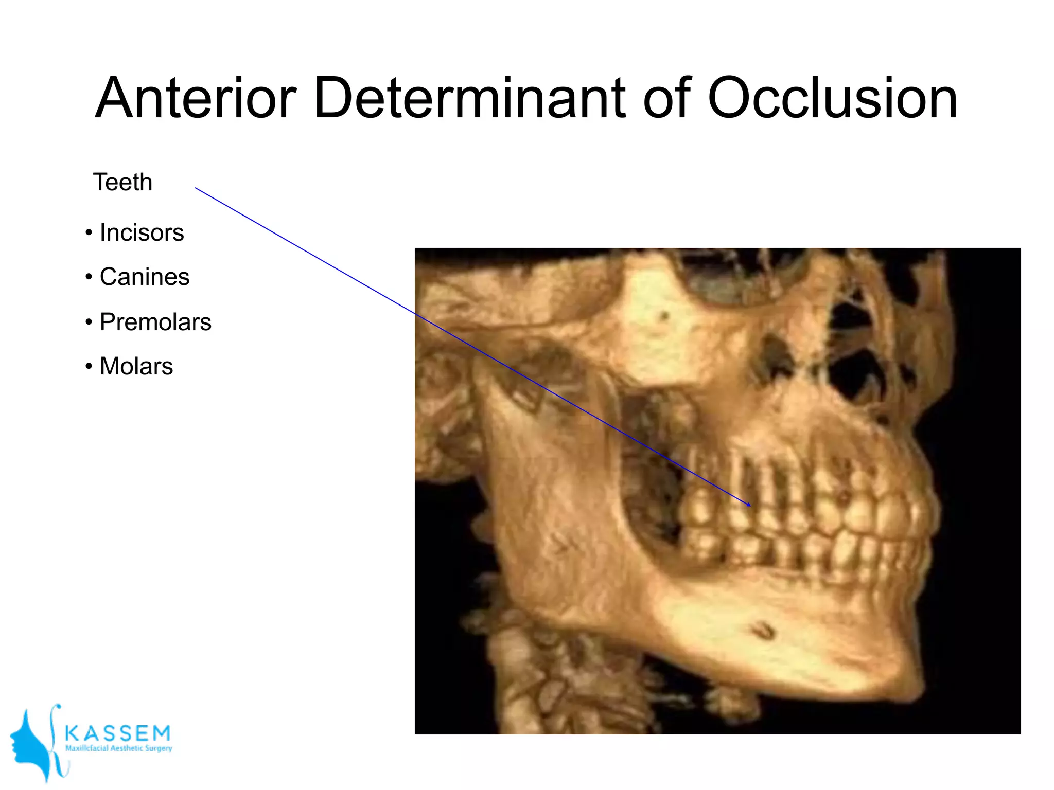 Pathology of TMJ | PDF