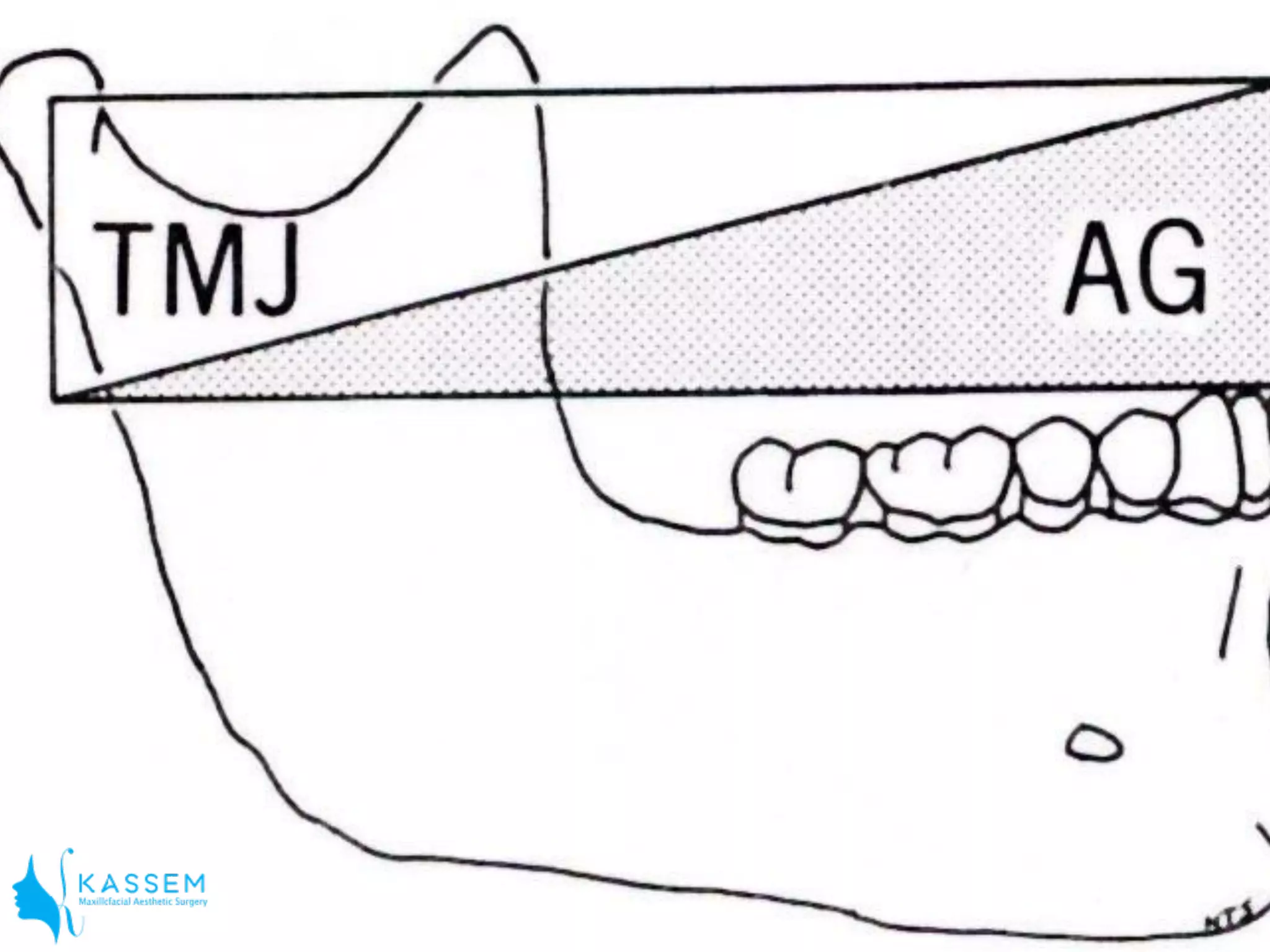 Pathology of TMJ | PDF | Dental Health | Diseases and Conditions