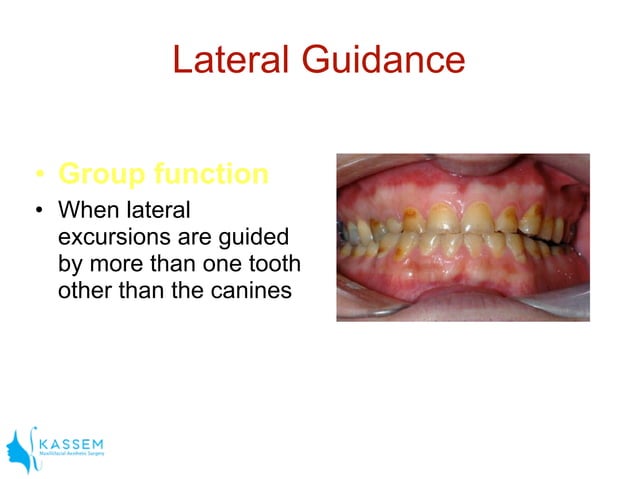 Pathology of TMJ | PDF | Dental Health | Diseases and Conditions
