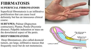 pathology of masculoskeletal disorders.. | PPTX