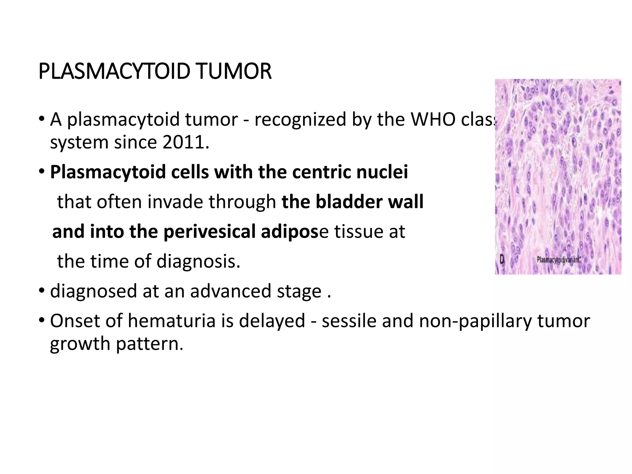 Pathology ca bladder | PPTX
