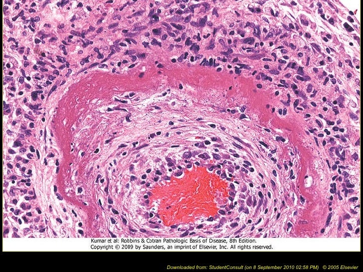 Pathology cell injury i