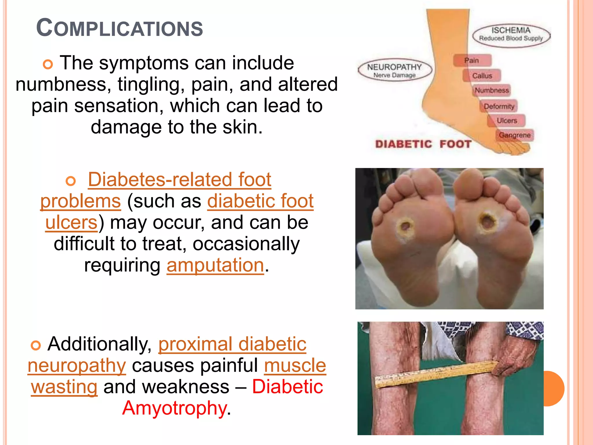 Diabetes Mellitus | PPTX