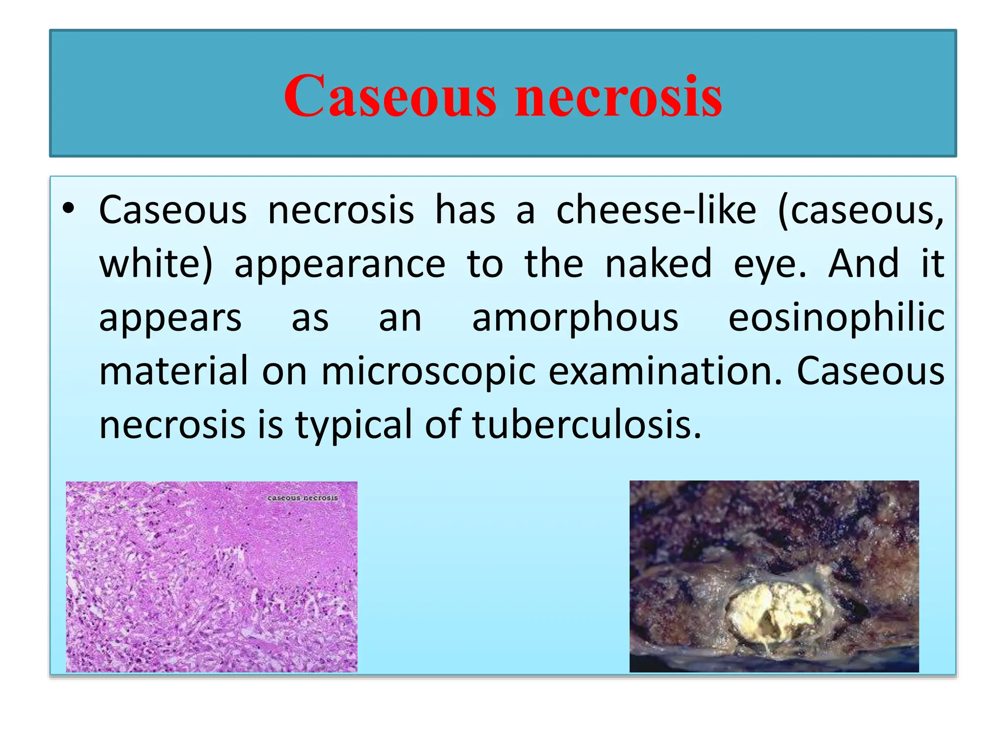 PATHOLOGY -Dr- Ammar Omar -Assistant professor of Histopathology ...
