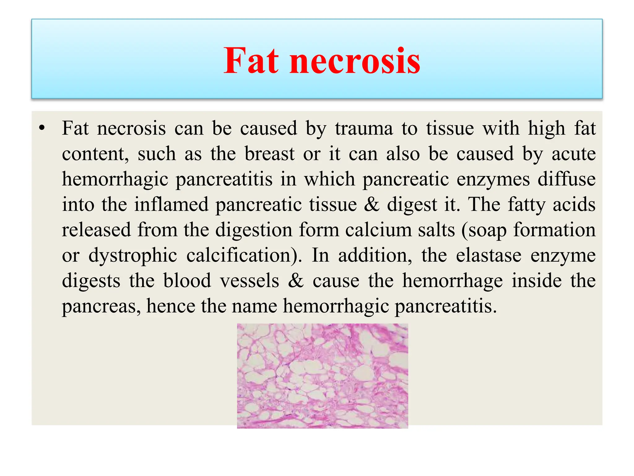 PATHOLOGY -Dr- Ammar Omar -Assistant professor of Histopathology ...