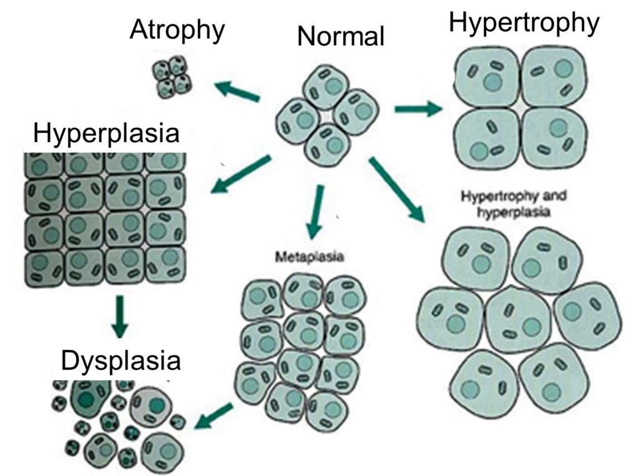 PATHOLOGY -Dr- Ammar Omar -Assistant professor of Histopathology ...
