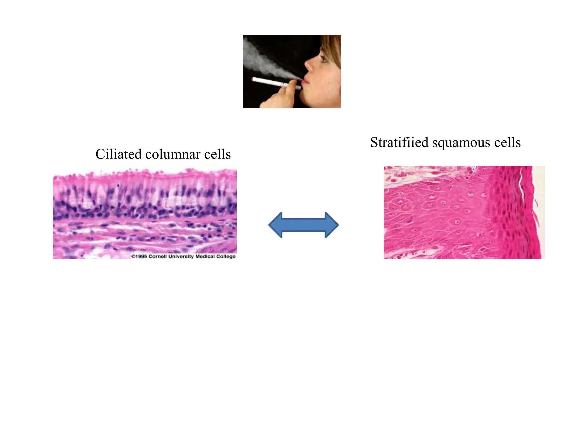 PATHOLOGY -Dr- Ammar Omar -Assistant professor of Histopathology ...