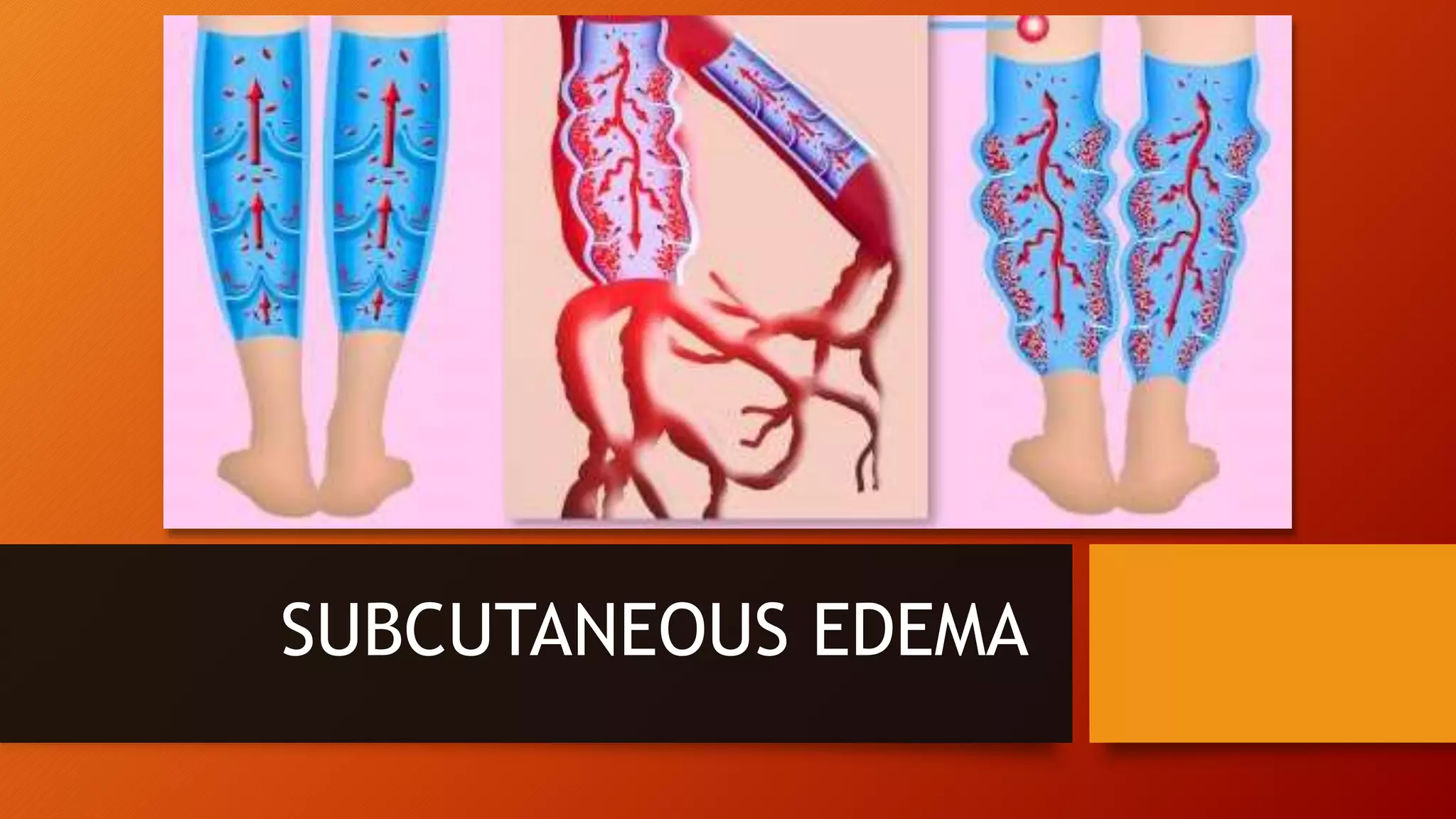 Pathology - Edema.pptx