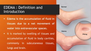 Pathology - Edema.pptx