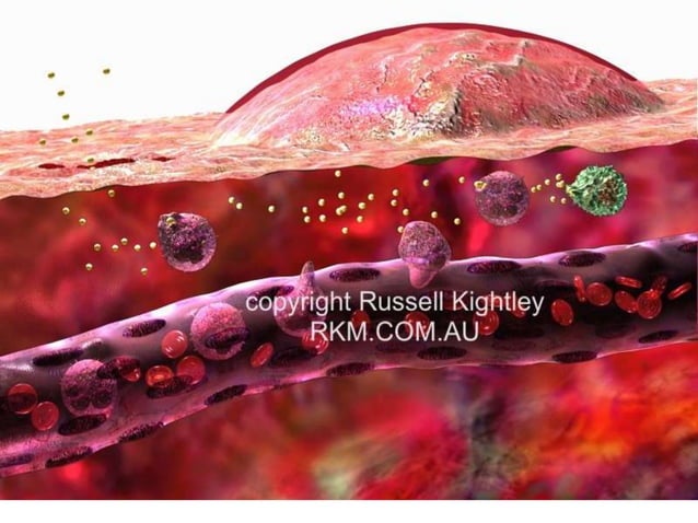 Complement System, Coagulation & Kinin System | PPTX