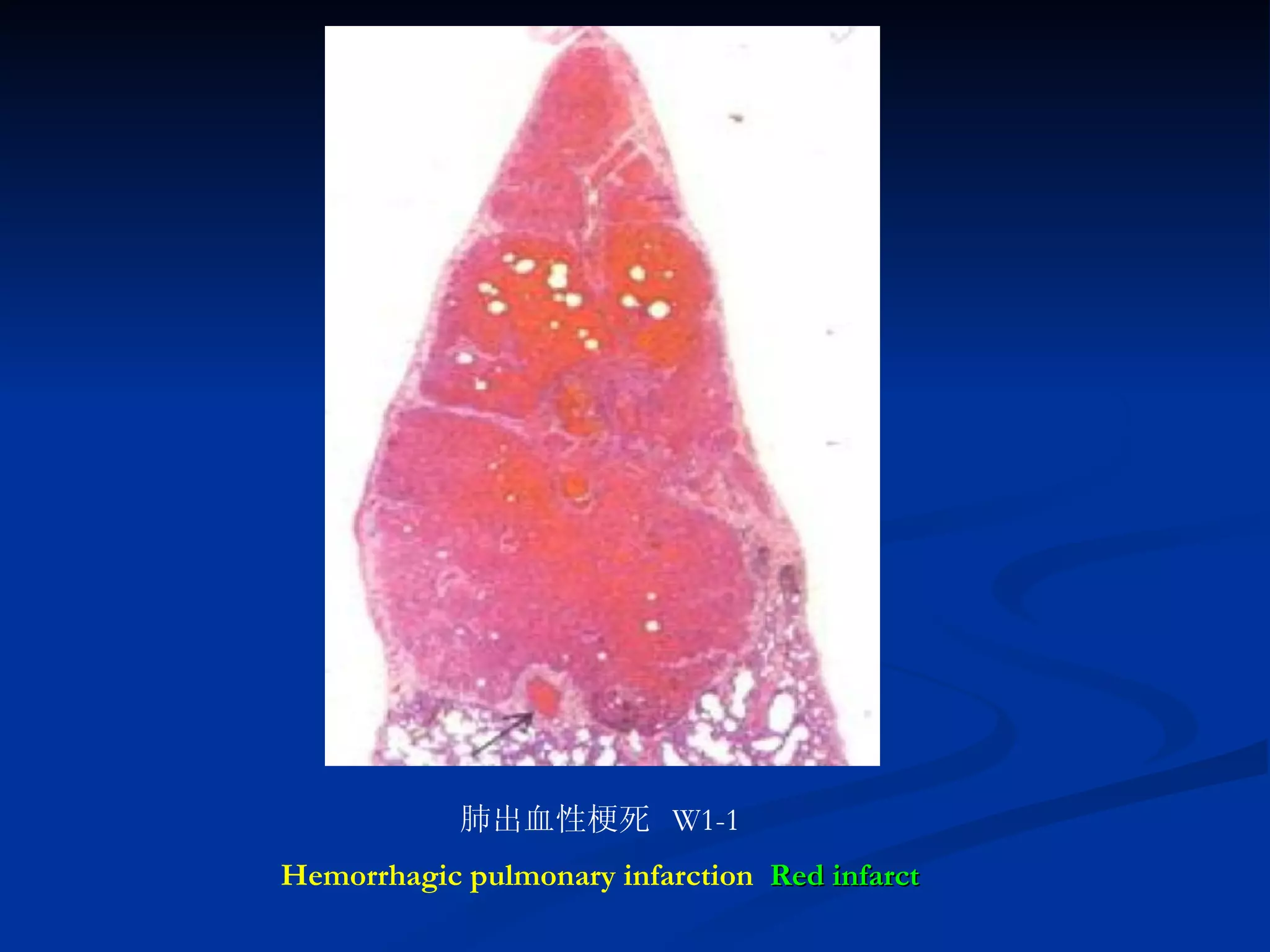 pathology practical original slide NO1 | PPT