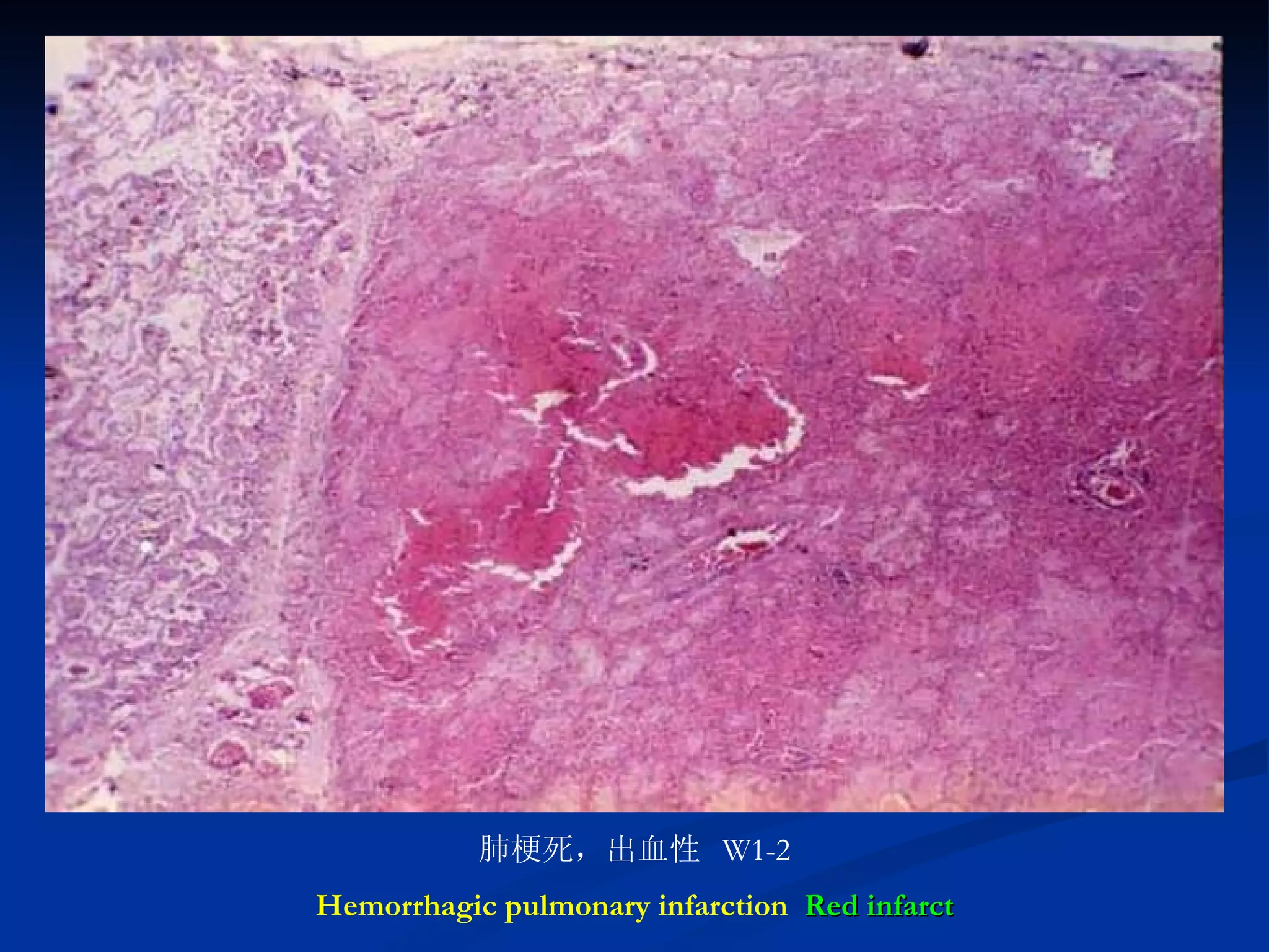pathology practical original slide NO1 | PPT