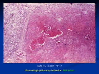 pathology practical original slide NO1 | PPT