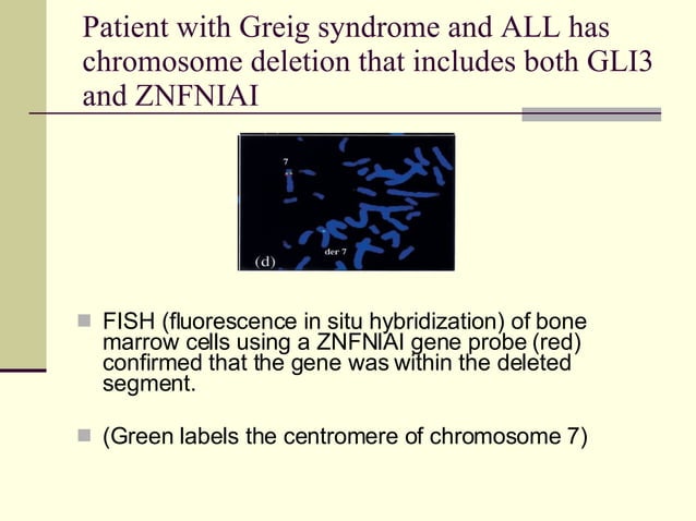 Greig Cephalopolysyndactyly Syndrome | PPT