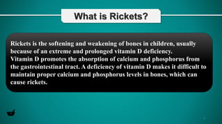 Rickets | PPT