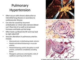 Comprehensive Overview of Respiratory Diseases and Pulmonary ...